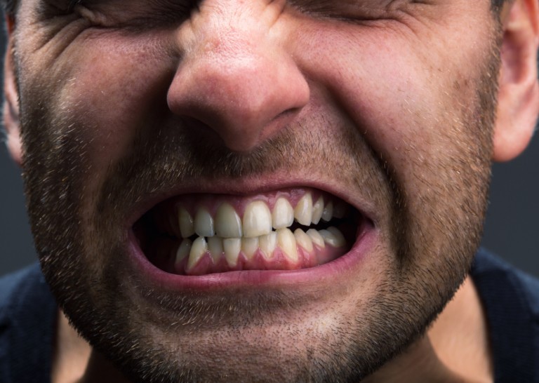 4 Reasons You’re Clenching Your Teeth (And How to Stop)